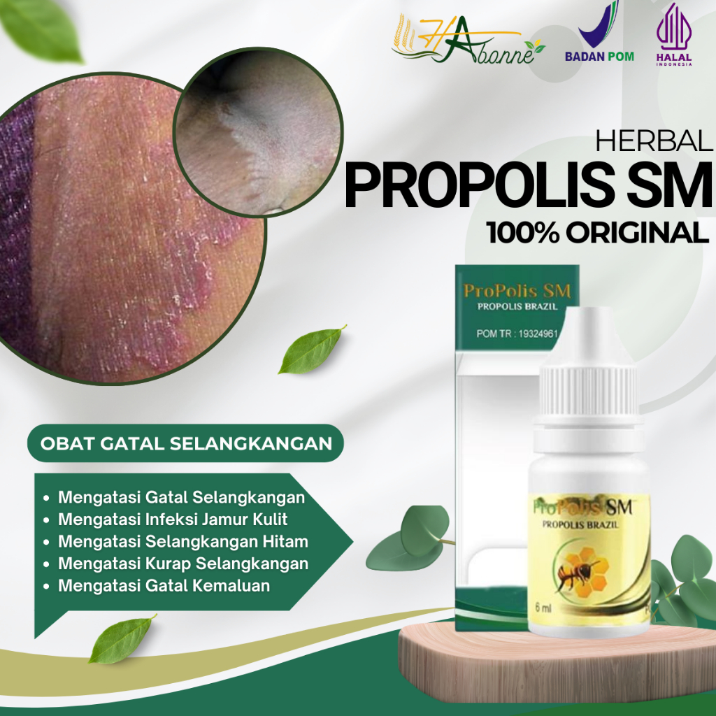 Jual Obat Gatal Selangkangan Tinea Cruris Selangkangan Hitam Infeksi ...
