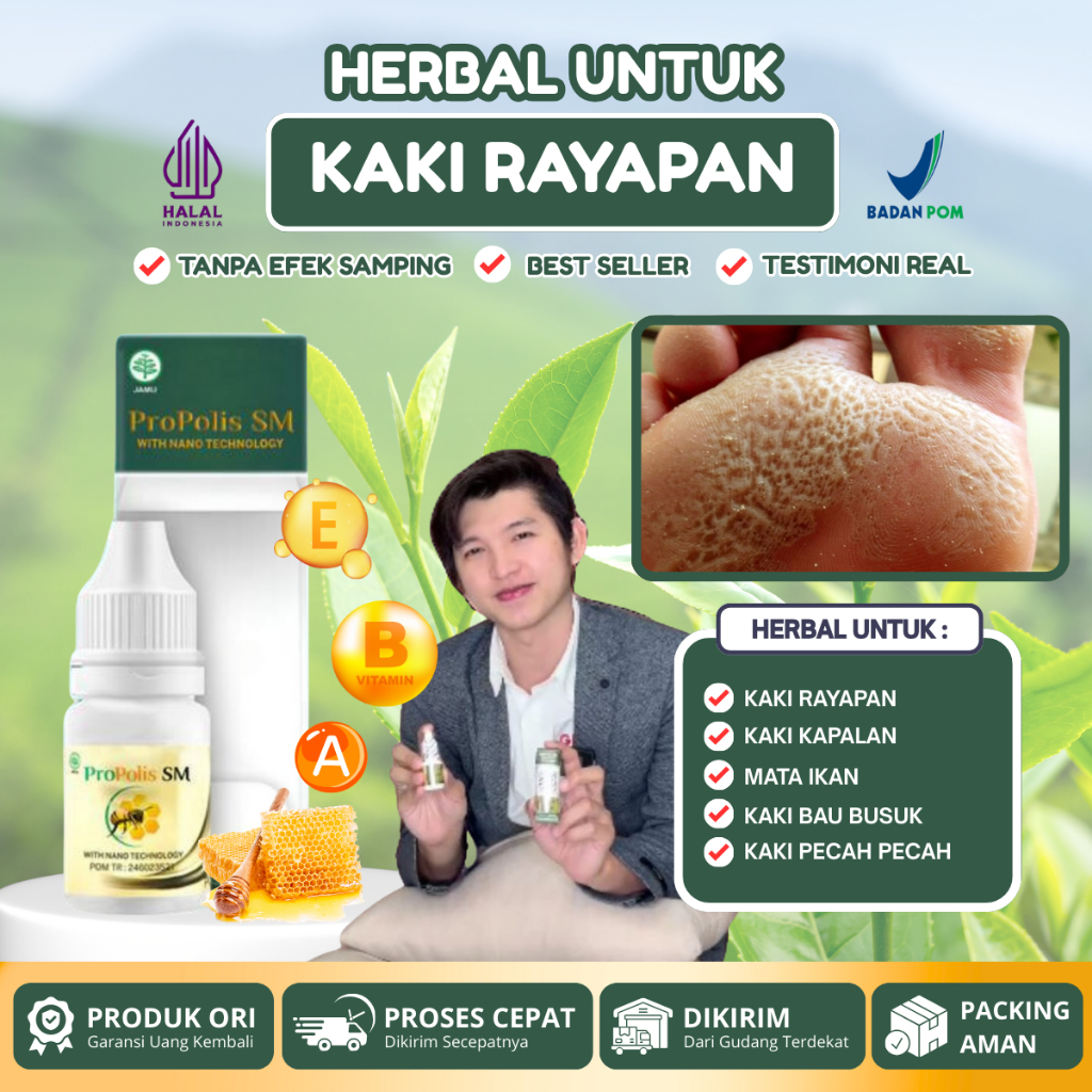 Jual Obat Kaki Rayapan bau kaki, Kaki Berlubang Bolong, kaki pecah dan ...