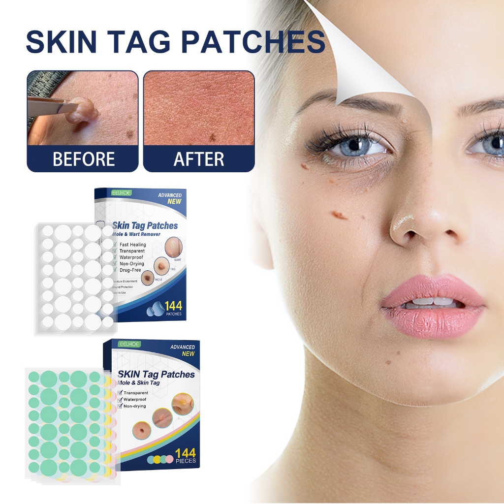 Jual Wart Verruca Care Patches Wart Verruca Removes Warts Verrucas ...
