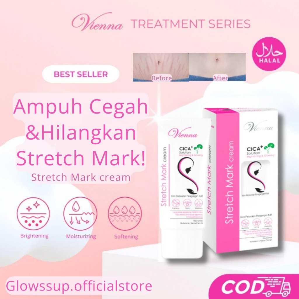Jual CREAM PENGHILANG STRETCH MARK VIENNA STRETCH MARK CREAM ORIGINAL ...