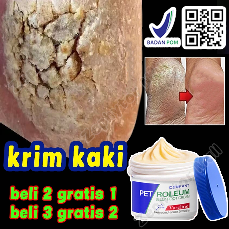 Jual BPOM salep kaki pecah2 paling ampuh pelembab kaki kering dan pecah ...