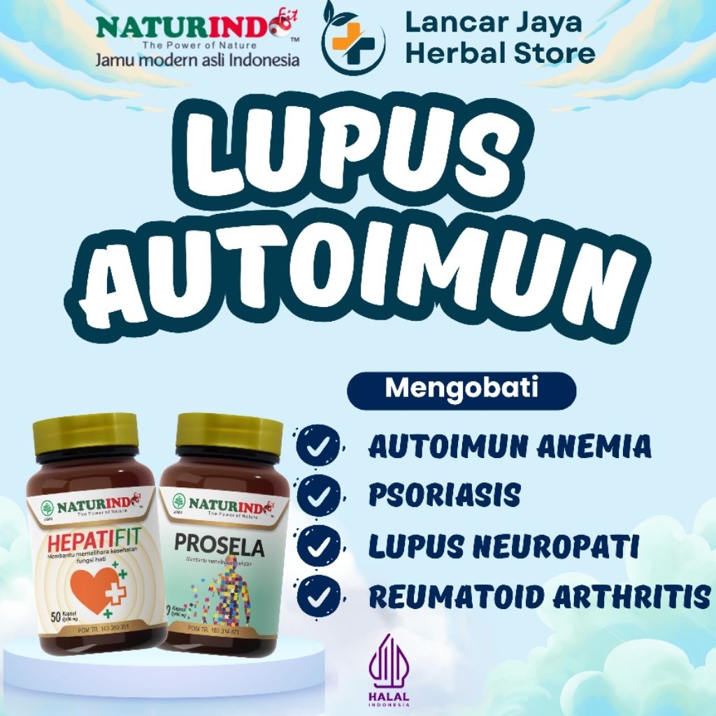 Jual Obat Lupus SLE Autoimun Nyeri Sendi Psoriasis AIHA Rheumatoid ...