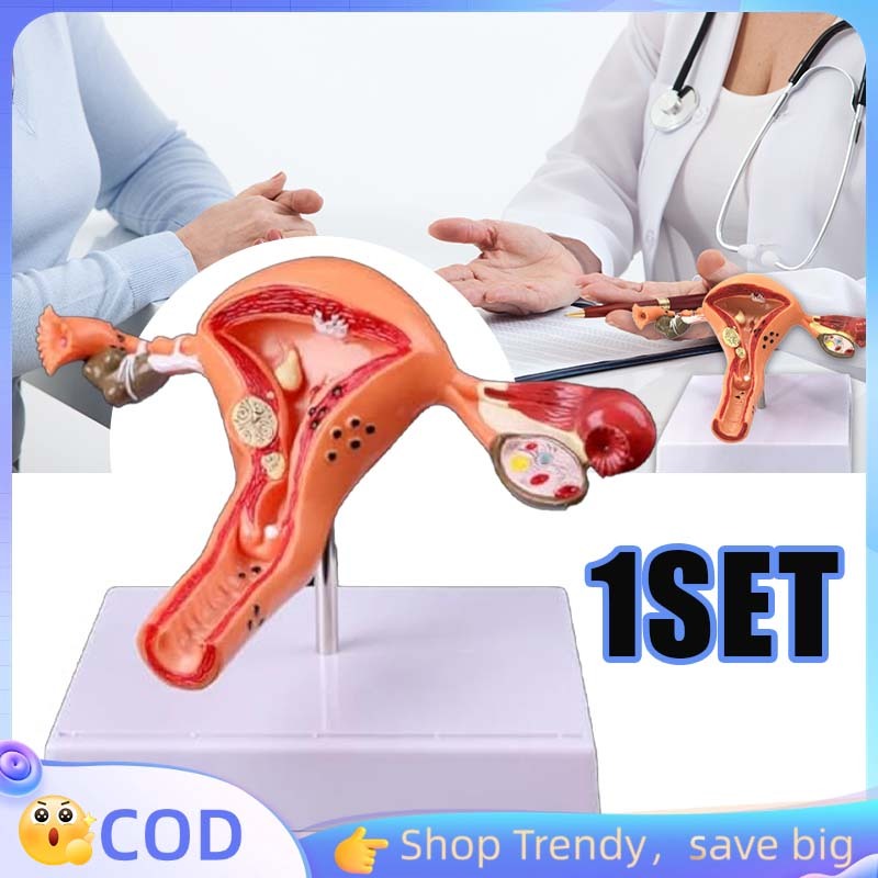 Jual Uterus Ovary Anatomical Model Manikin Uterus Ovary Model Alat ...