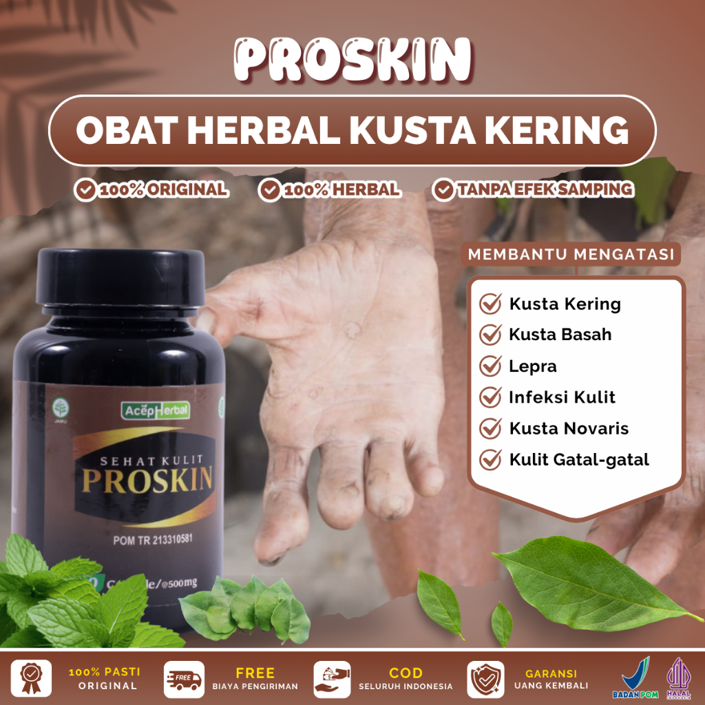 Jual Proskin Untuk Kusta Kering, Kusta Basah, Lepra, Gatal-gatal BPOM ...