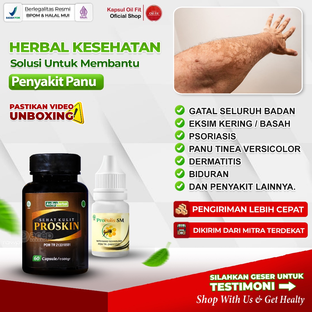 Jual Obat Panu Psoriasis Gatal Kulit Kepala Kurap Gatal Selangkangan ...