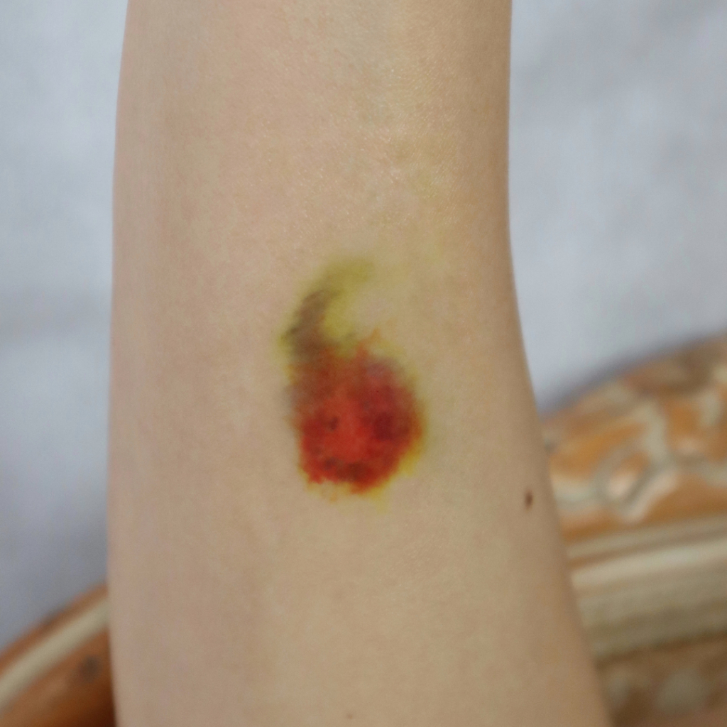 Jual [PRODUK LOKAL] TATO TEMPORER SMALL HEALING BRUISE | LUKA LEBAM ...