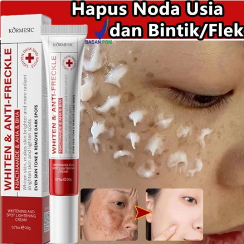 Jual Cream flek hitam membandel bpom salep flek hitam membandel cream ...
