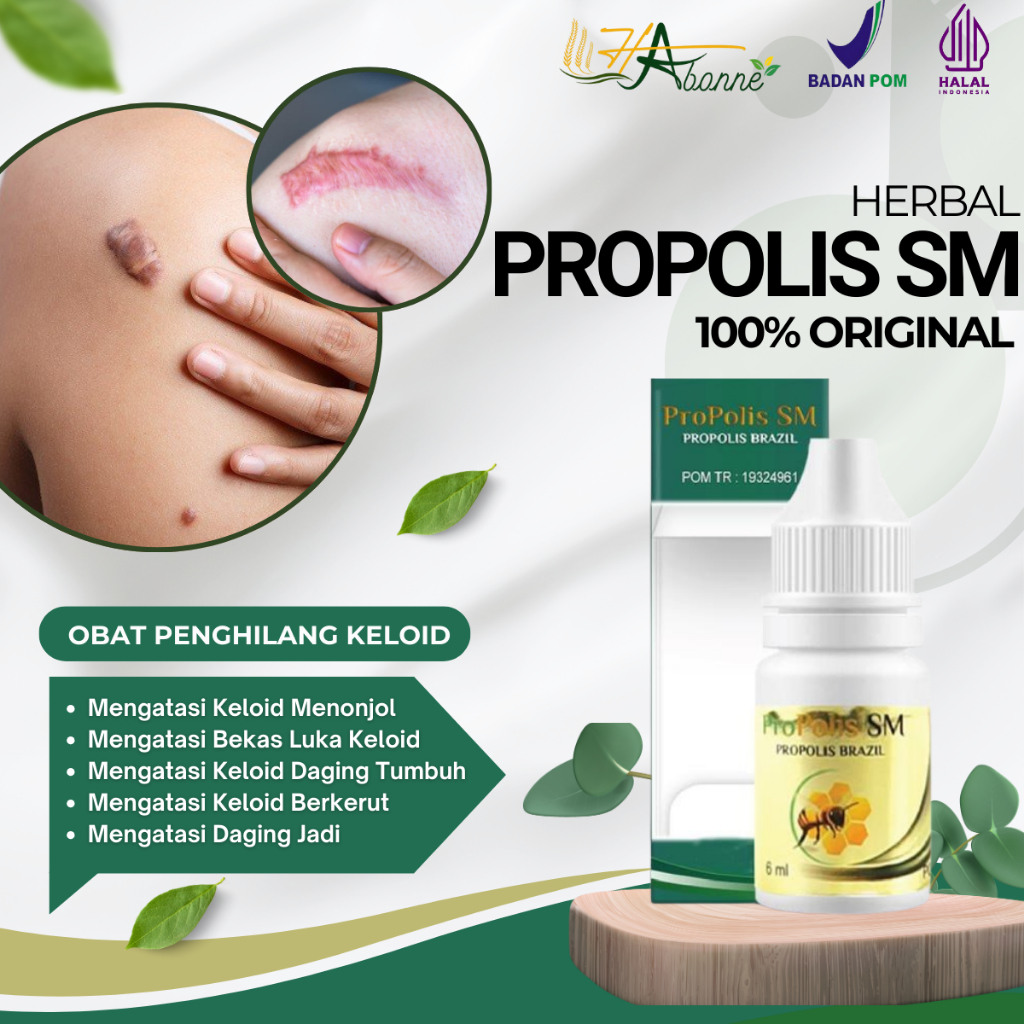 Jual HAbonne - Obat Keloid Menonjol Tahunan, Bekas Luka Menonjol ...