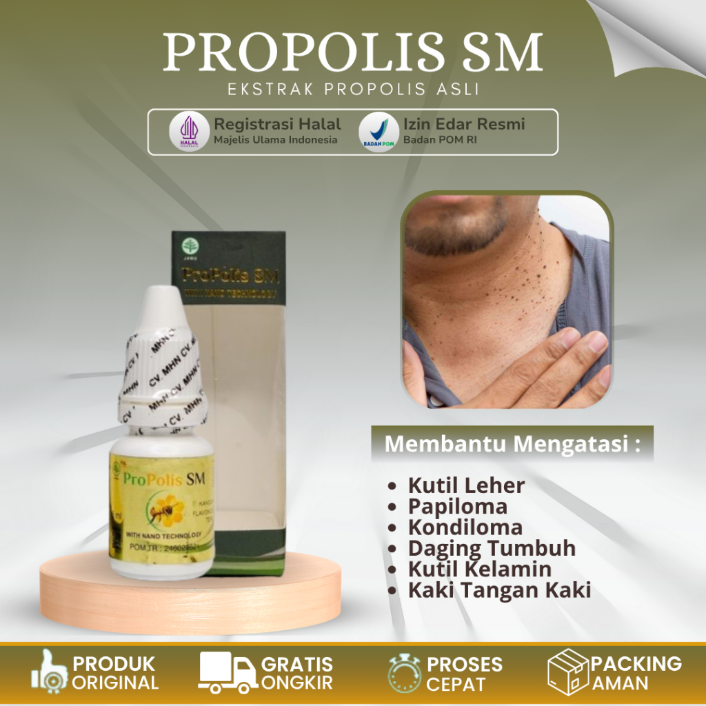 Jual Obat Pengempis Daging Tumbuh, Obat Skin Tag, Obat Penghilang ...