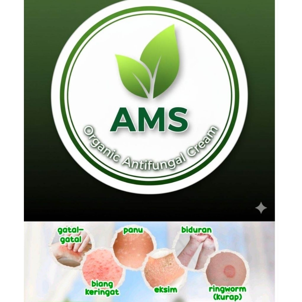 Jual AMS Antifungal Cream Malaya Ampuh 100% | Shopee Indonesia