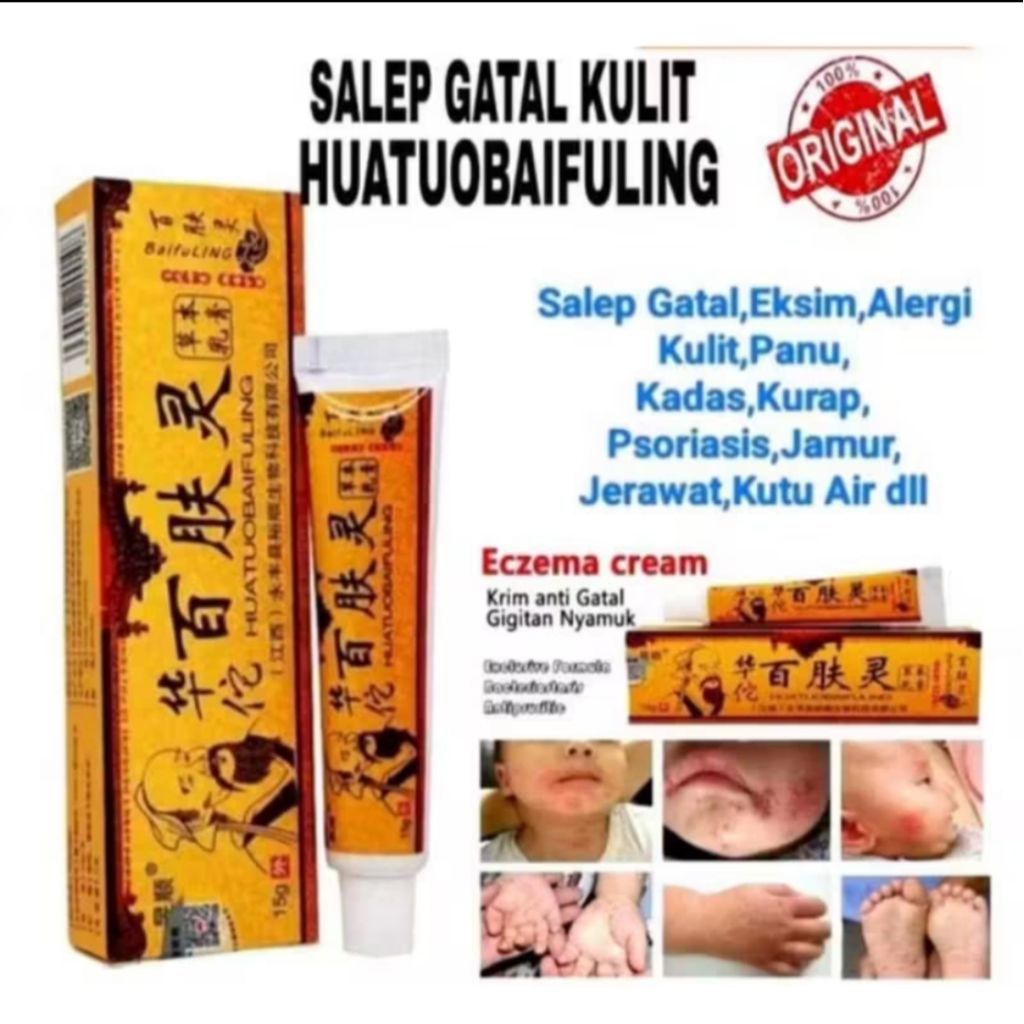 Jual PROMO 𝟯 𝗣𝗖𝗦 Salep Gatal Cina Ampuh 𝗖𝗔𝗣 𝗢𝗥𝗔𝗡𝗚 𝗧𝗨𝗔 𝐎𝐫𝐢𝐠𝐢𝐧𝐚𝐥 𝟏𝟎𝟎% Cap ...