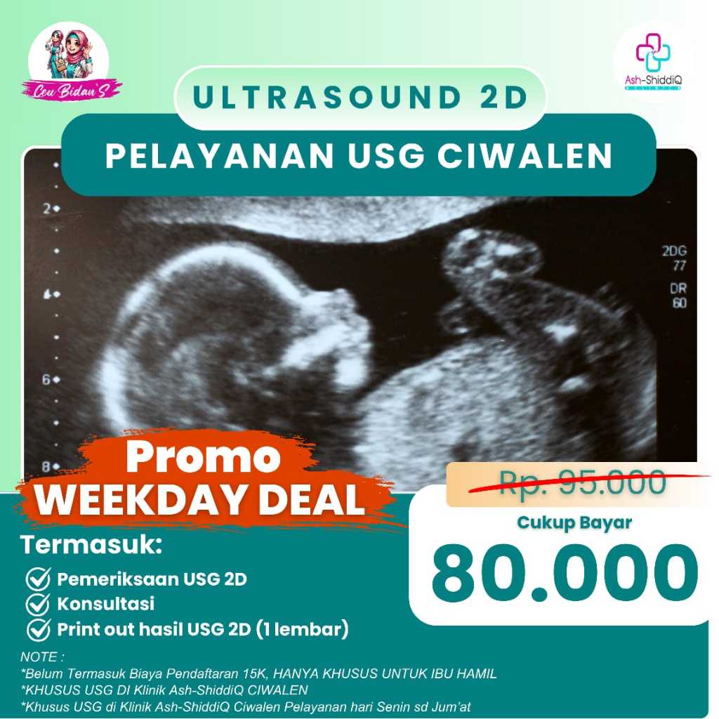 Jual USG 2D PROMO WEEKDAY - Print Out hasil USG 2D (1 Lembar ...