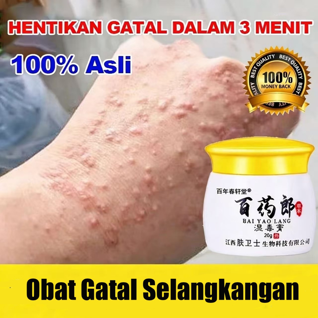 Jual Salep Eksim Kering dan Gatal Salep Gatal China Paling Ampuh Obat ...