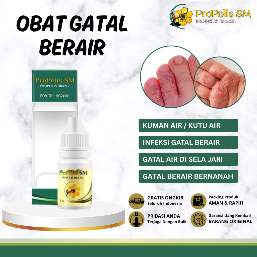 Jual Obat Gatal Berair, Obat Kuman Air, Obat Kutu Air, Obat Bintik ...