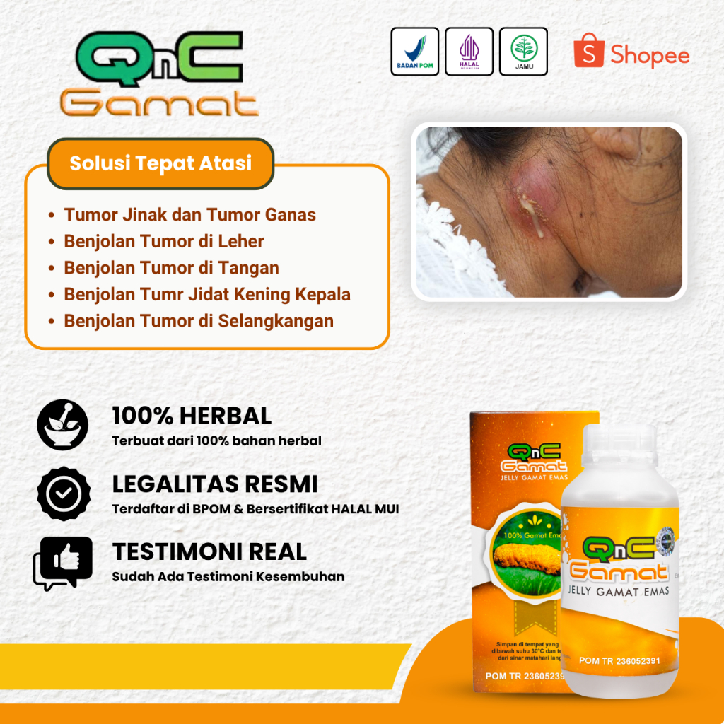 Jual Obat Tumor Herbal, Penghancur Sel Tumor, Penghilang Benjolan ...