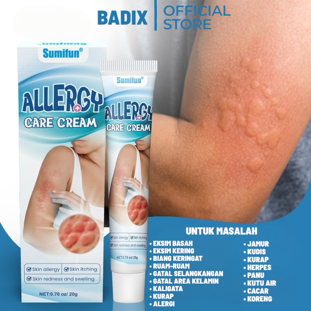 Jual Allergy Care Cream - Krim Penghilang Gatal & Alergi Kulit | Salep ...