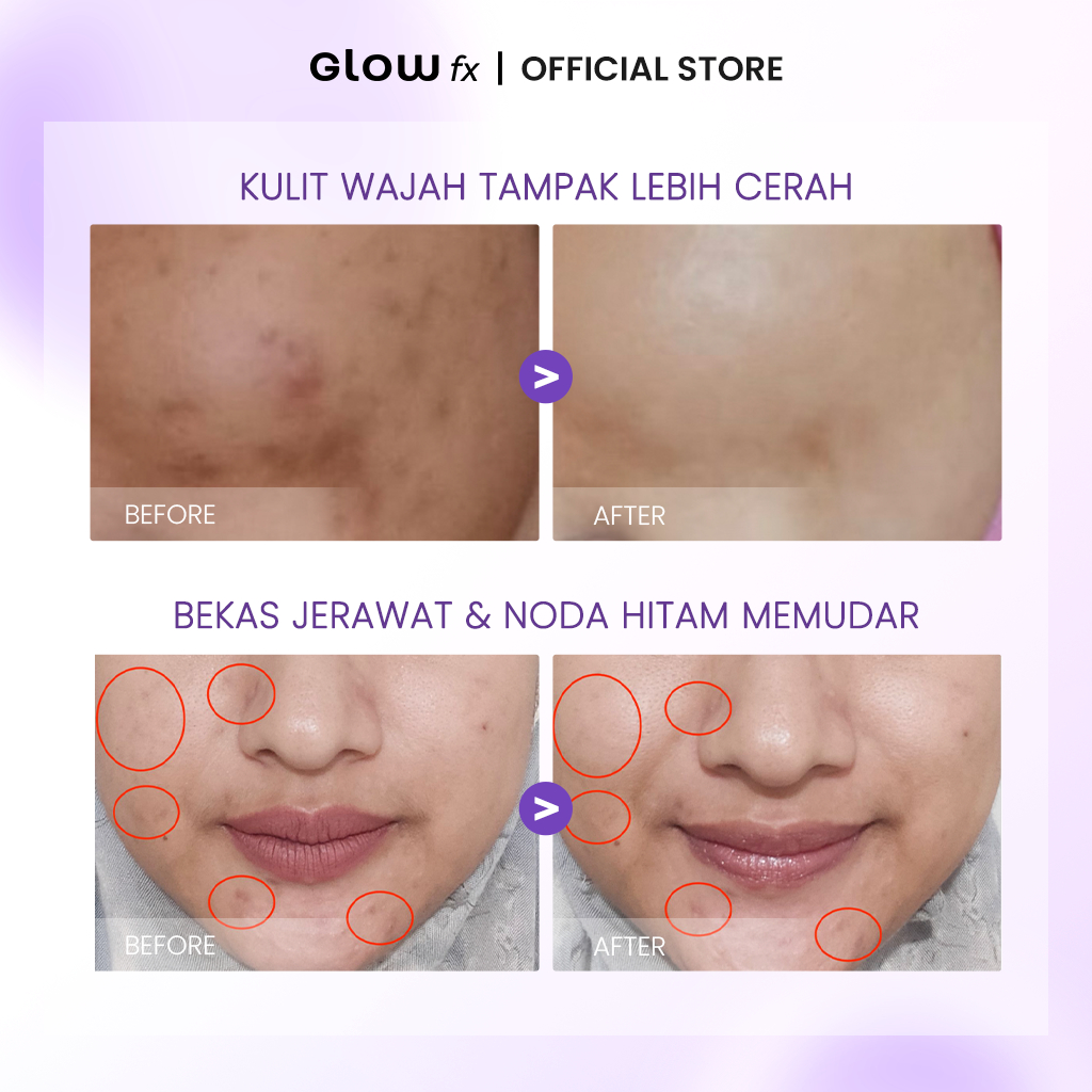Jual GLOW FX - Ultimate Glow Duo - Glow Bomb Brightening Serum 20ml ...