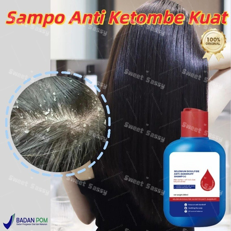 Jual Selenium Disulfide Shampoo 300ML-Oil Control Anti-Dandruff Anti ...