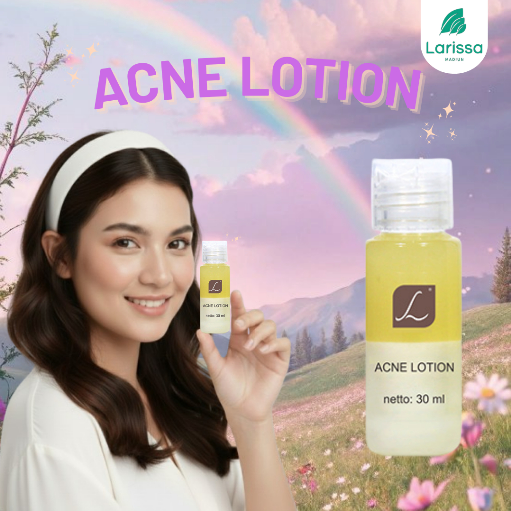 Jual Larissa - Acne Lotion 30ml Mengandung Sulfur | Skincare Obat ...