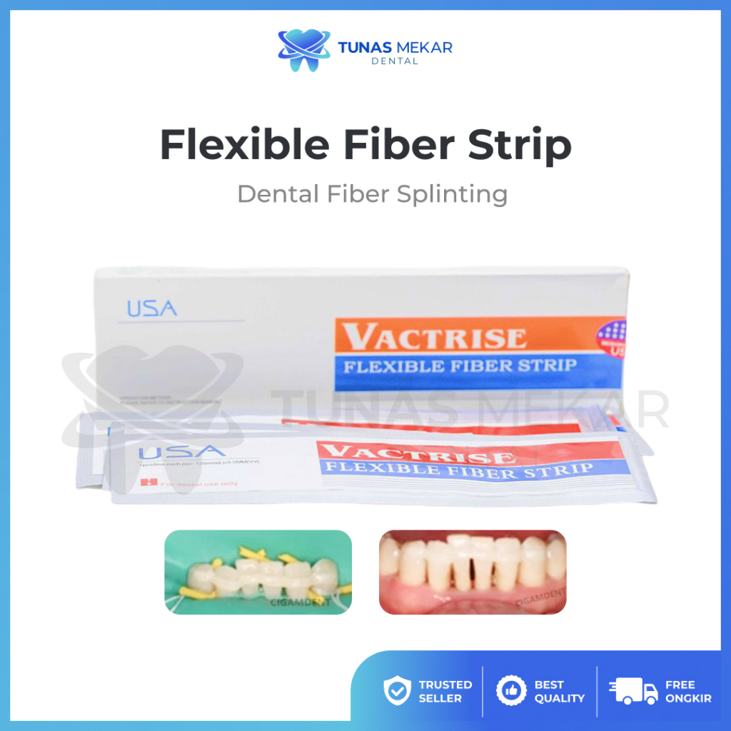 Jual Dental Fiber Splinting Splint Strip Endo | Shopee Indonesia