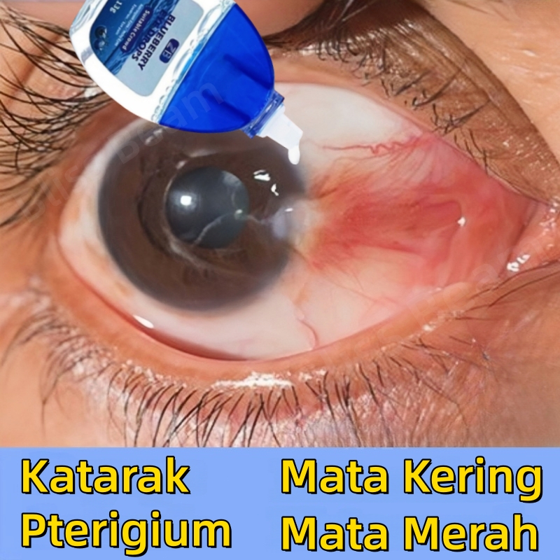 Jual Alat tetes mata Pengobatan katarak mata merah mata minus pterygium ...