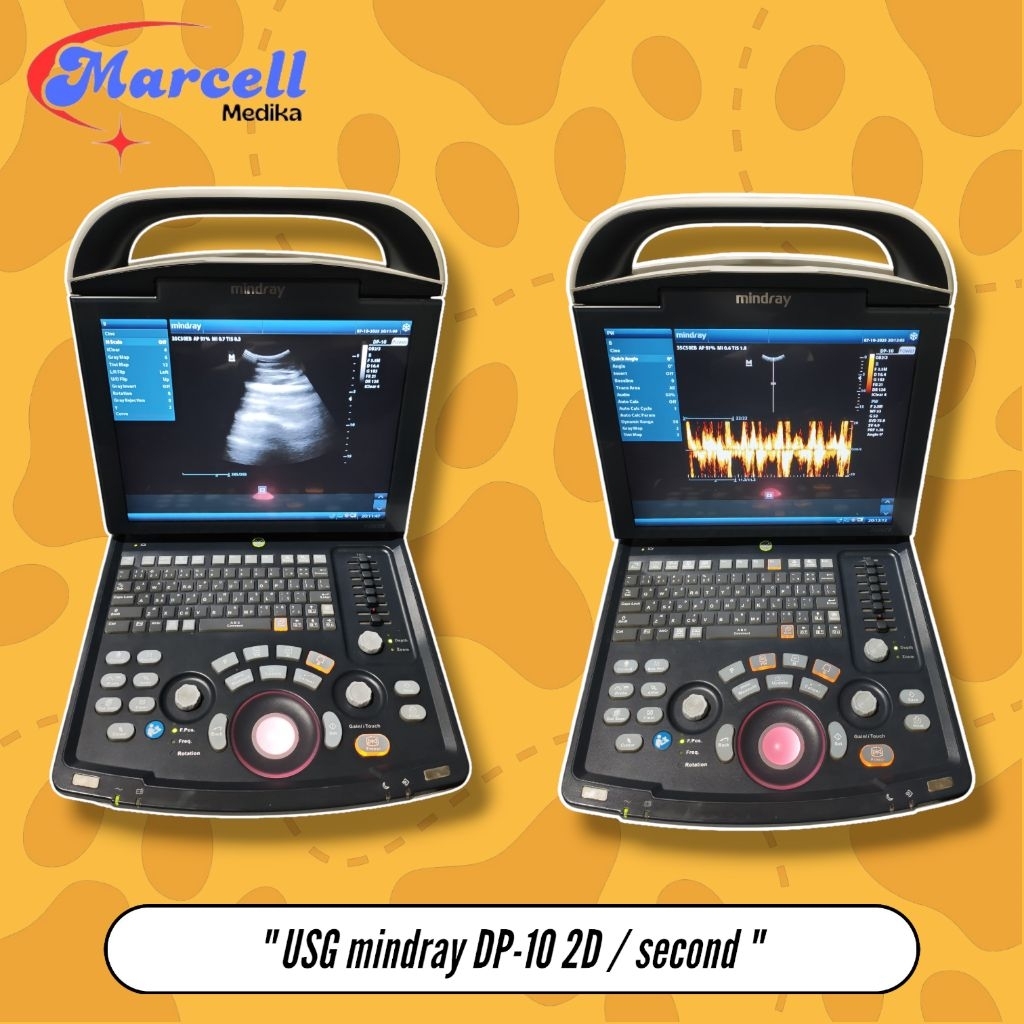 Jual USG MINDRAY DP-10 2D DOPPLER / ALAT CEK USG MINDRAY DP-10 second ...