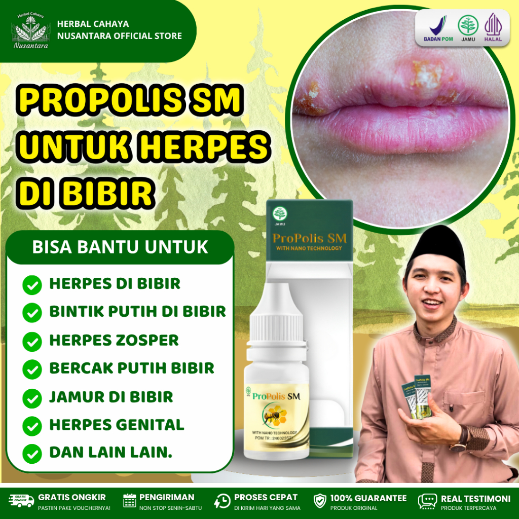 Jual Obat Herpes Bibir Zosper Bintik bintik Bercak Putih di Bibir ...
