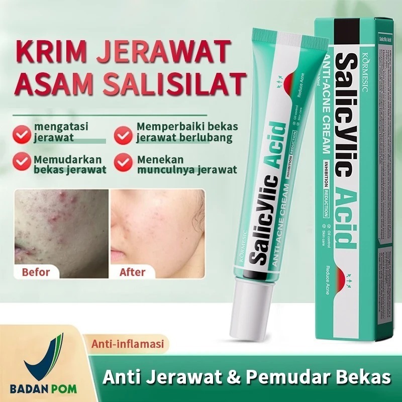 Jual Salicylic Acid Cream Terlengkap & Harga Terbaru Juni 2026 | Shopee ...