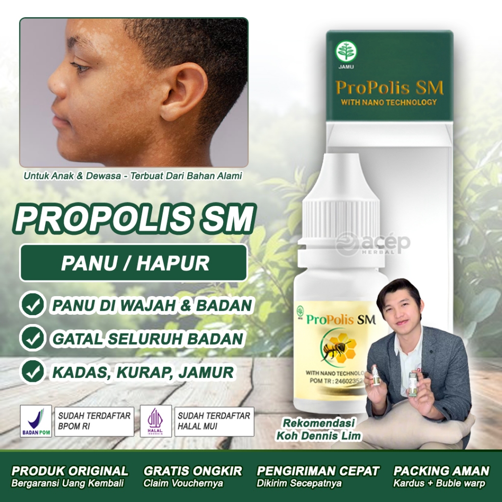 Jual Obat Balas Bogo Penghilang Panu Di Wajah Dan Badan Bercak Putih ...