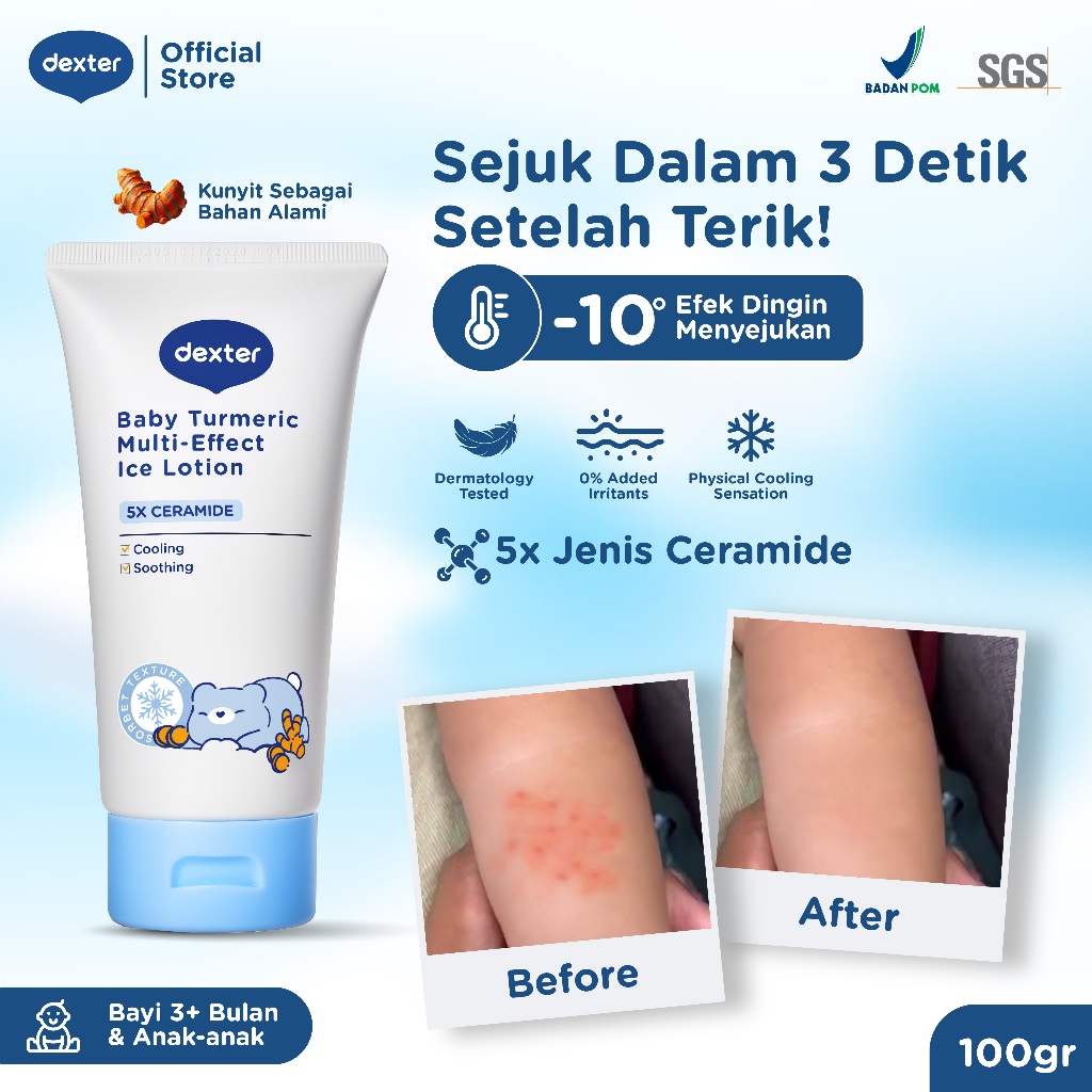 Jual DEXTER Baby Turmeric Multi-Effect Ice Lotion 100 g | Pelembab ...