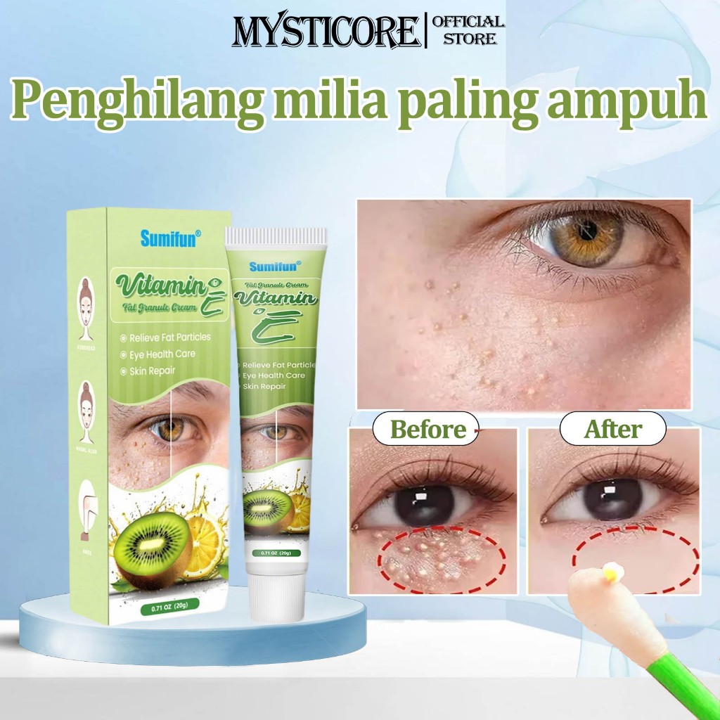 Jual MYSTICORE Krim penghilang milia 20g Obat milia paling ampuh Salep ...