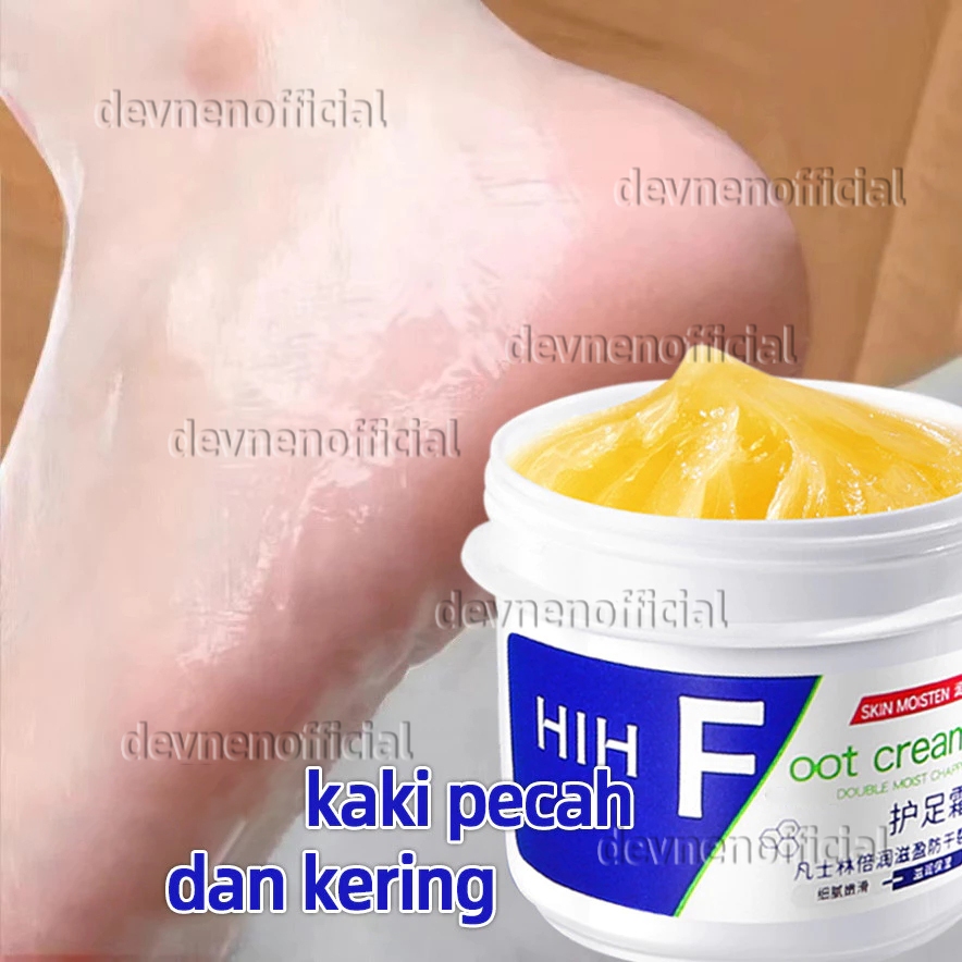 Jual kaki pecah dan kering Foot cream Obat kaki pecah Pelembab kaki ...