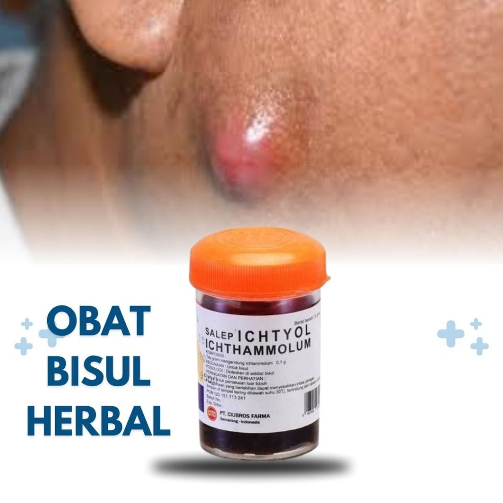 Jual Ichitol Salep Tar Hitam Pengering Bisul Dan Obat Bisul Bernanah ...