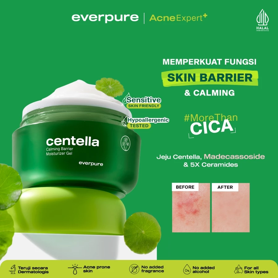 Redakan Masalah Kulit dengan Rangkaian Skincare Everpure - Info Cantika ...