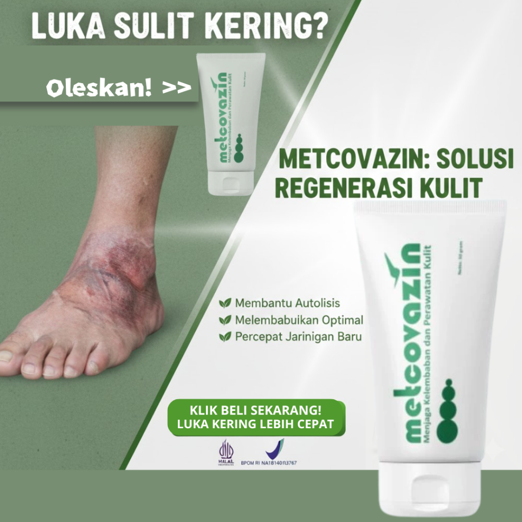 Jual Salep Metcovazin Original Penyembuh Luka Diabetes Bernanah Cepat ...