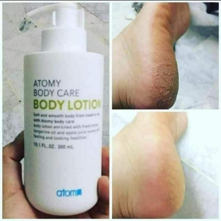 Jual ATOMY LOTION TUBUH 300ML ORIGINAL LOTION | Shopee Indonesia