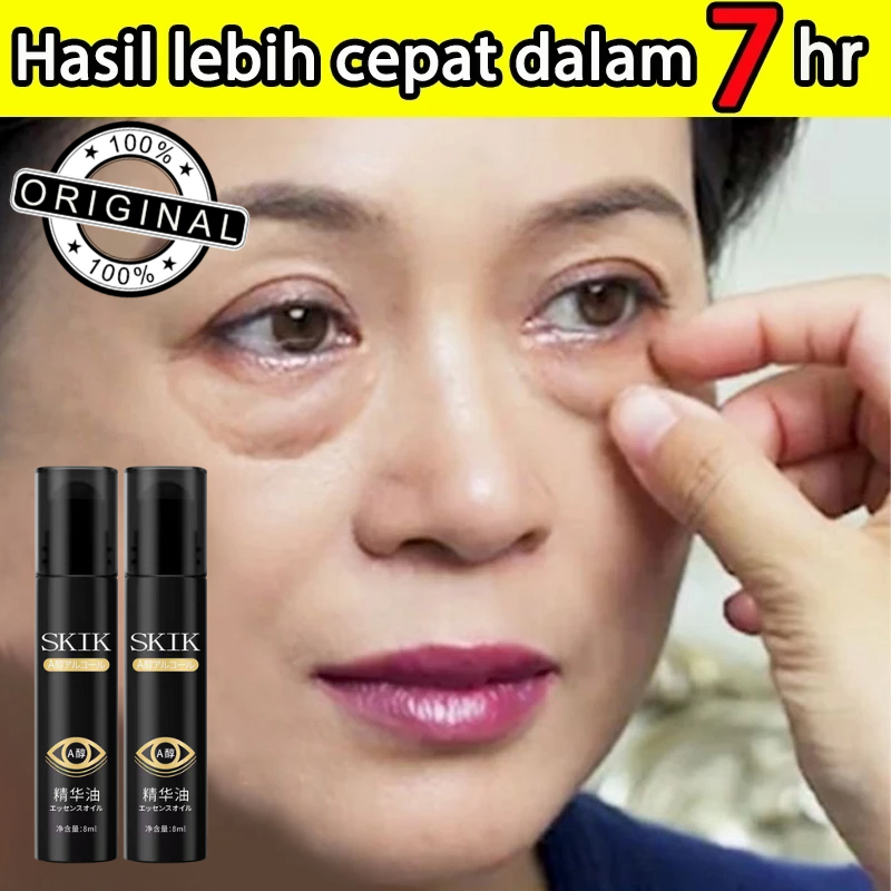 Jual Serum mata cream Menghilangkan Kantung Mata Dengan Cepat Krim mata ...