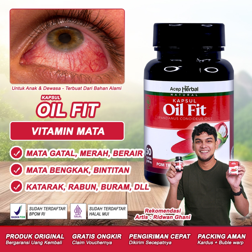 Jual Obat Mata Gatal Bengkak Bintitan Obat Mata Merah Berair Belekan ...
