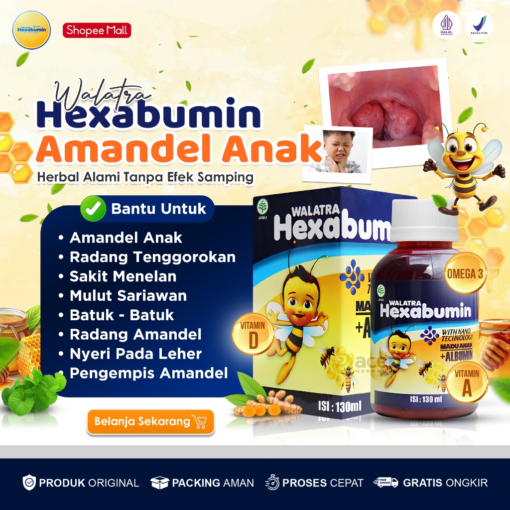 Jual Obat Amandel Anak Radang Tenggorokan Amandel Bengkak Sakit Menelan ...
