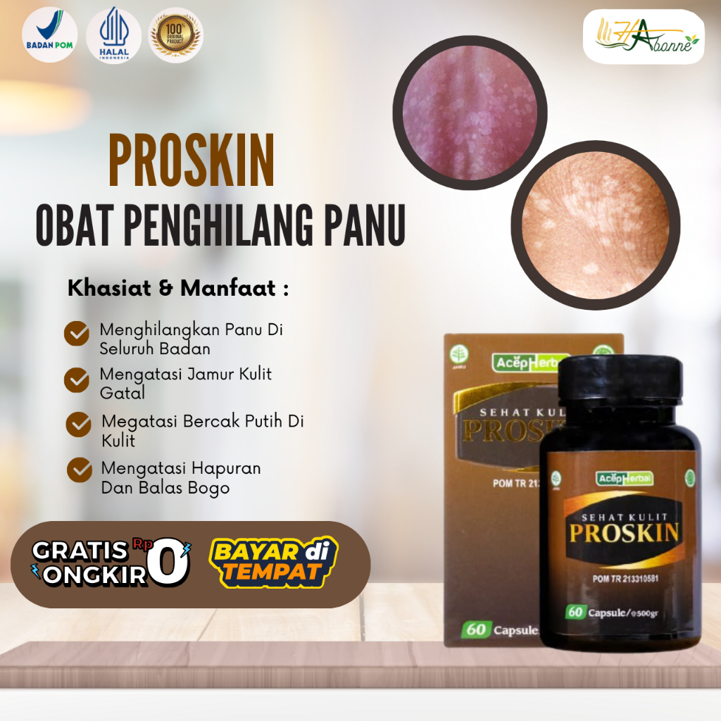 Jual Proskin Penghilang Panu Hapuran Panu Seluruh Badan Jamur Kulit ...