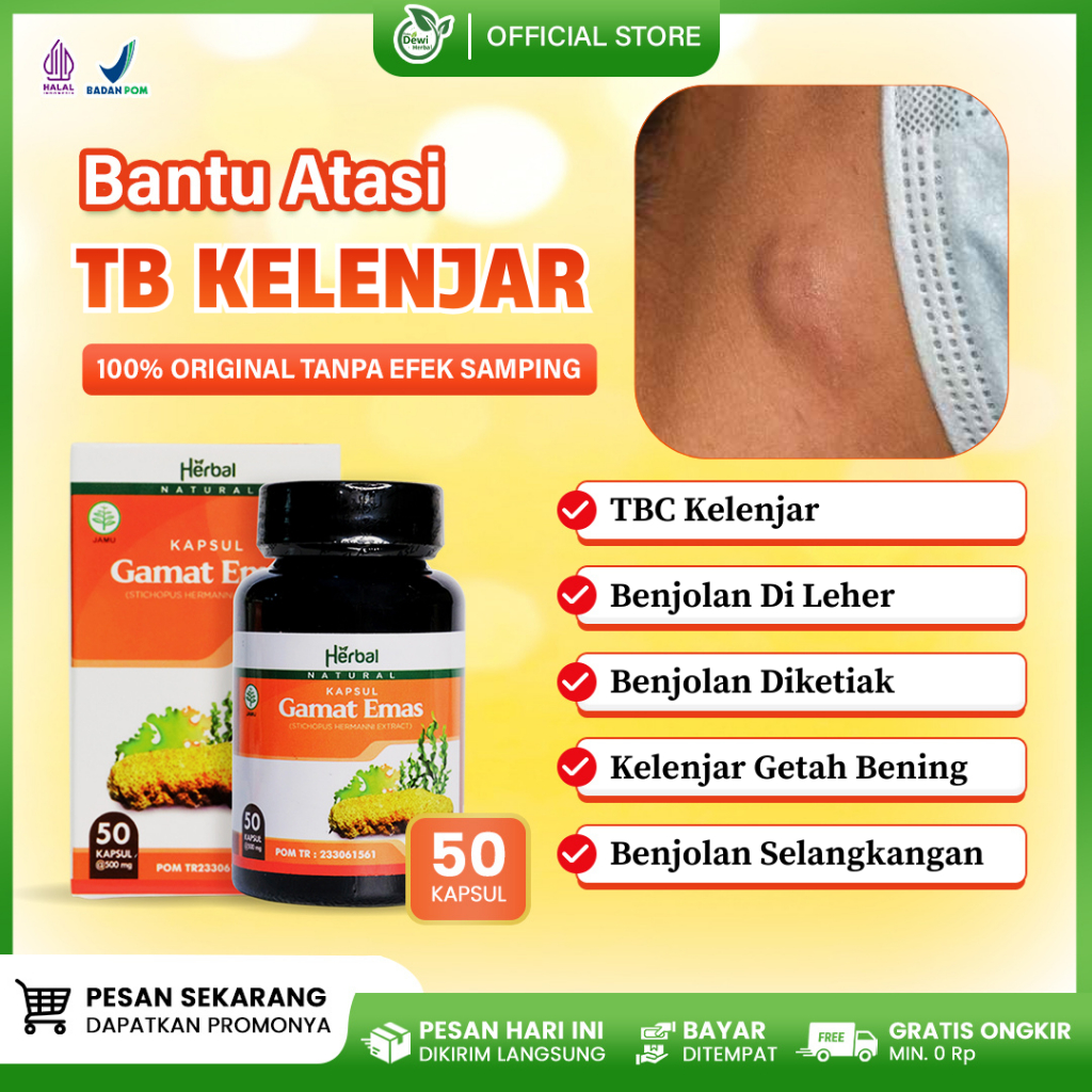 Jual Obat Herbal TB Kelenjar, TB Kelenjar Getah Bening, Benjolan Di ...