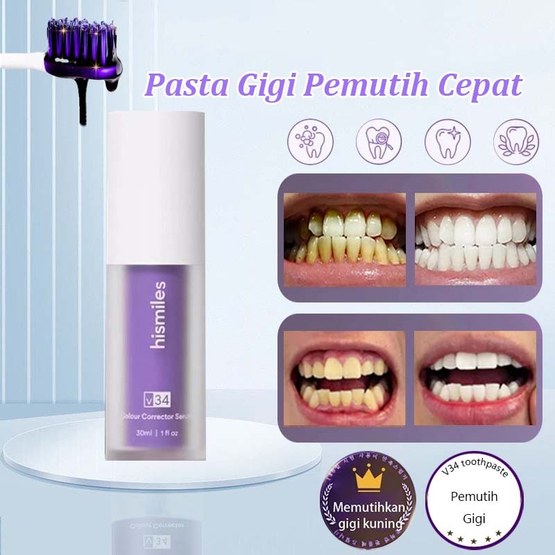 Jual Pasta Gigi Pemutih Gigi Kuning Odol Pemutih Gigi Dan Karang Gigi ...