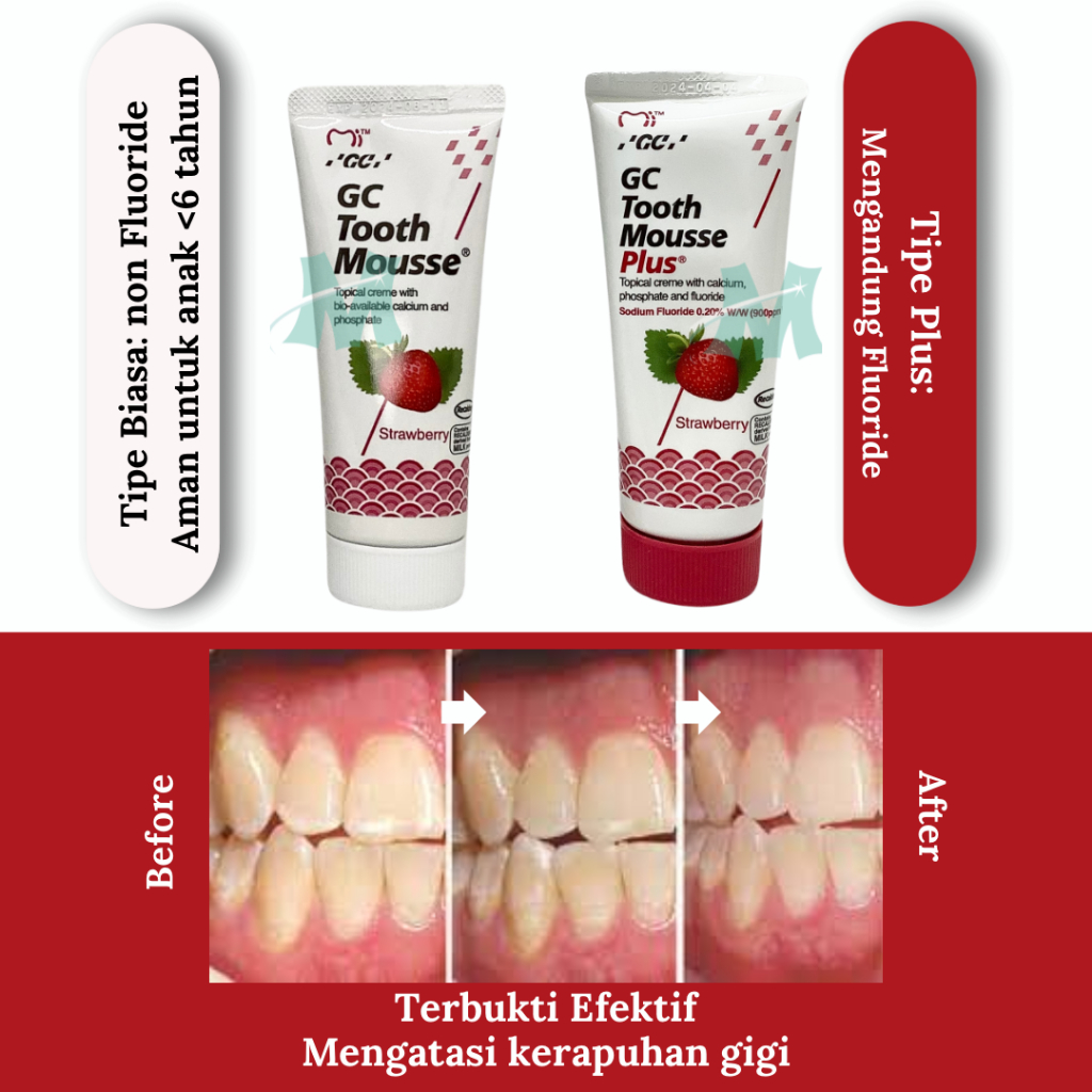 Jual Toothmousse Plus Vitamin Mineral Kalsium Fluor gigi | Shopee Indonesia