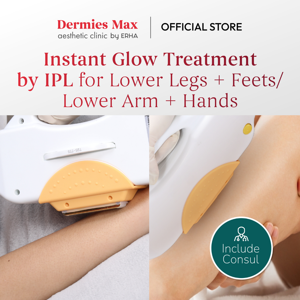 Jual Dermies Max Instant Glow Treatment By IPL For Lower Legs + Feets ...