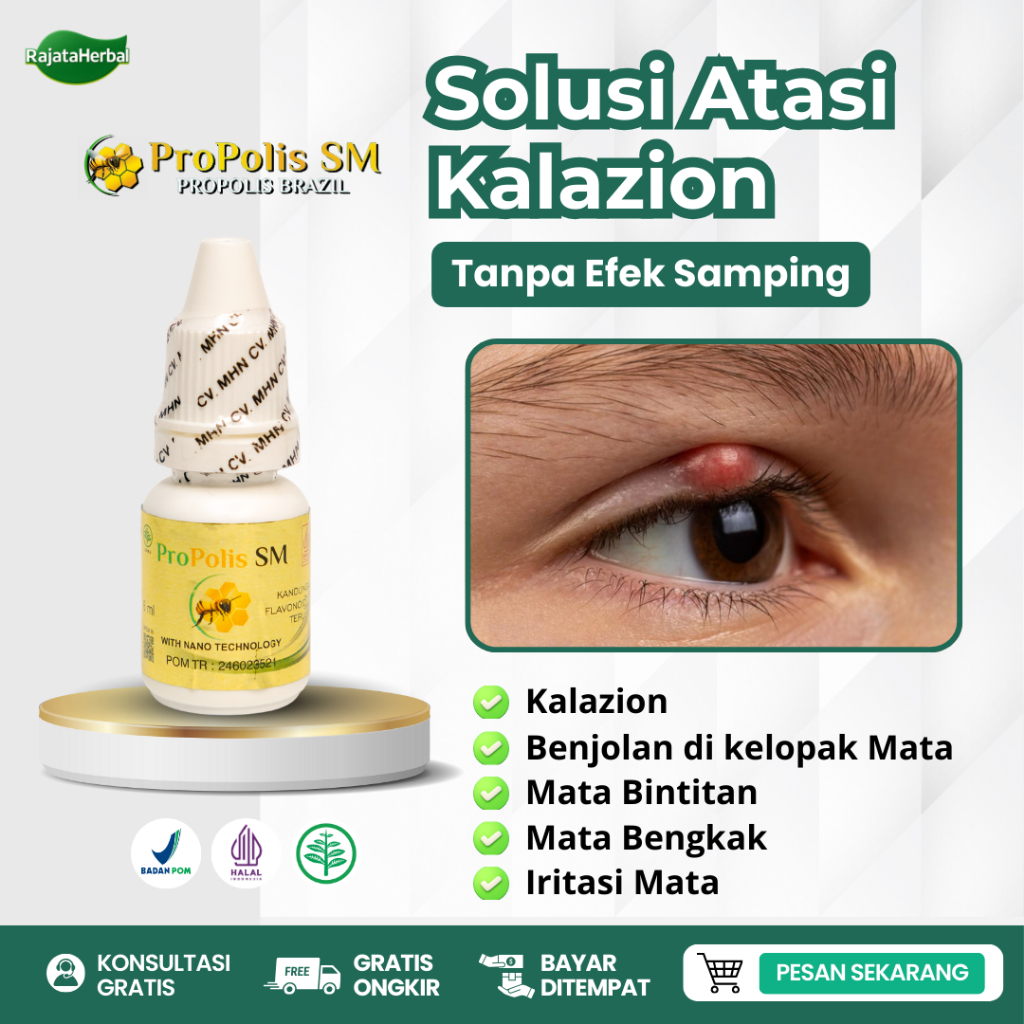 Jual Propolis SM Brazil Untuk Kalazion Benjolan di Kelopak Mata ...