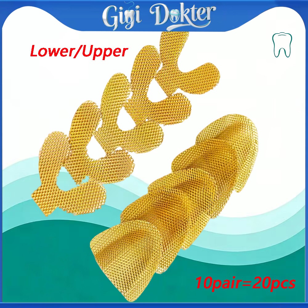 Jual Gigi Dokter 20Pcs Dental Metal Palatal Golden Reinforcement Mesh ...