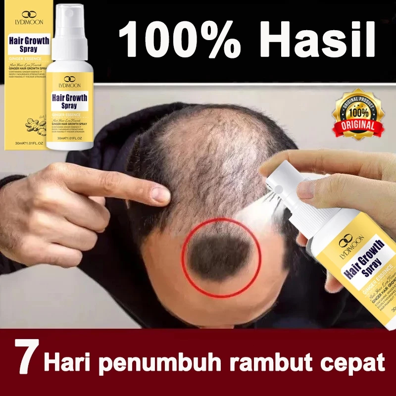 Jual Serum Penumbuh Rambut Cepat Dan Tebal Ginger Semprotan Penumbuh ...