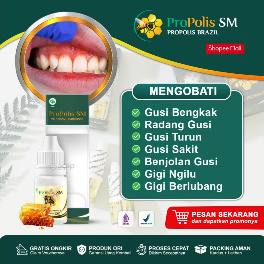 Jual Obat Radang Gusi, Obat Gusi Turun, Obat Infeksi Pada Gusi, Obat ...