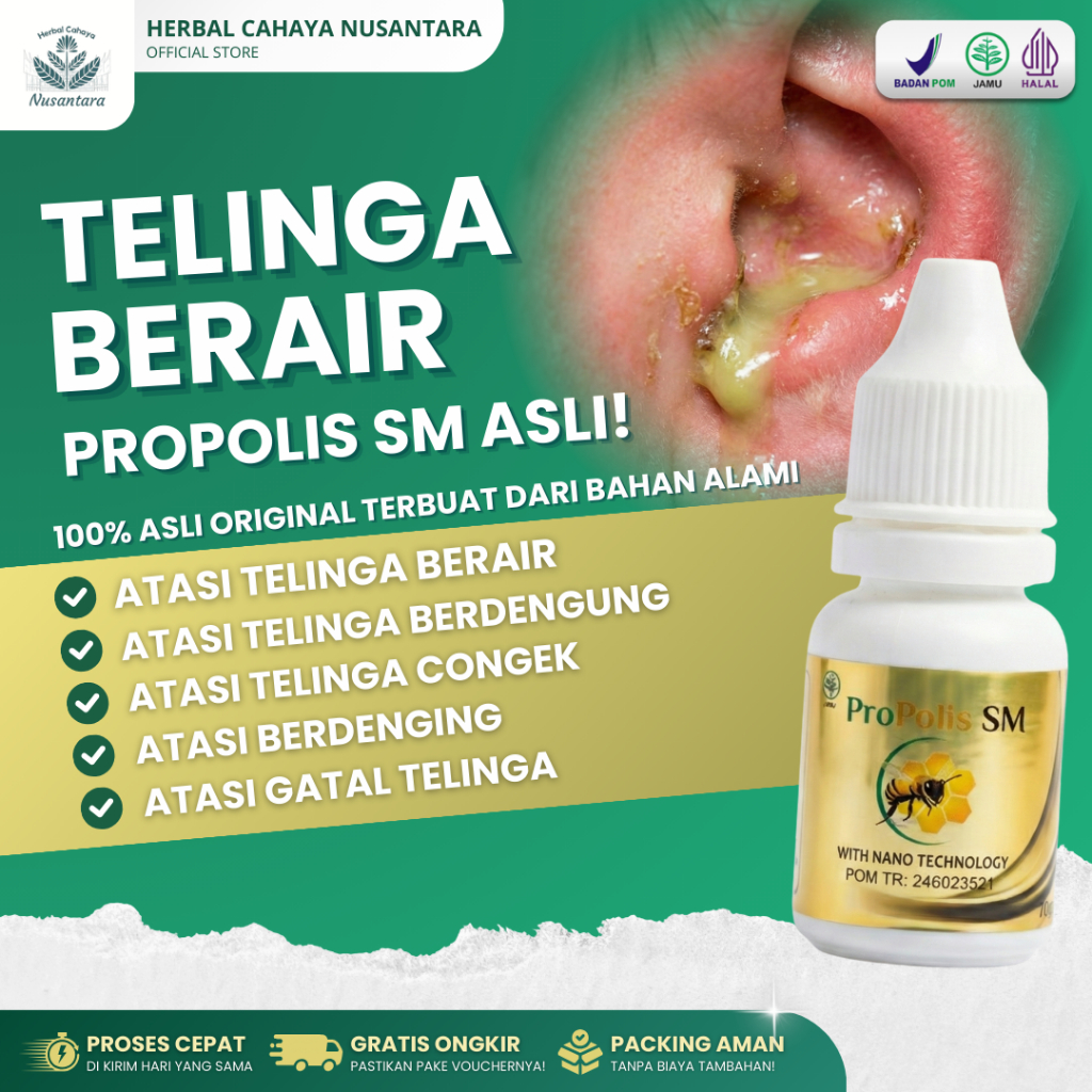 Jual Obat Tetes Telinga Berair Berdengung Congek Telinga Gatal ...