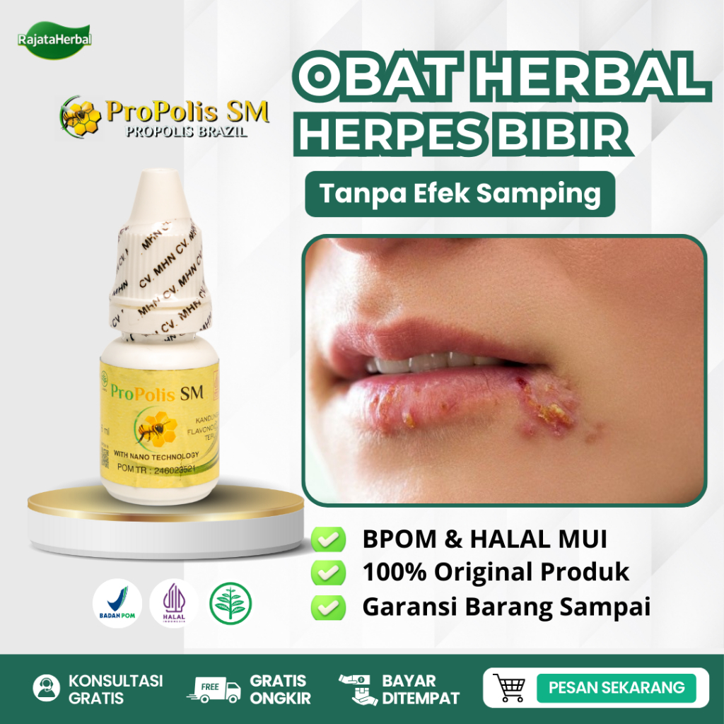 Jual Propolis SM Brazil 100% Herbal Halal BPOM Obat Herpes Bibir ...